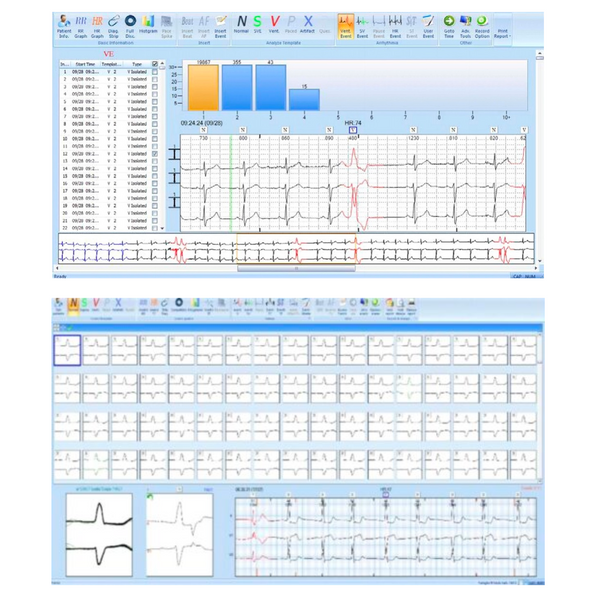 Holter ECG EuroHolter – Palma Salud